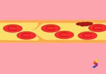 Define Clot, Clot Meaning, Clot Examples, Clot Synonyms, Clot Images ...